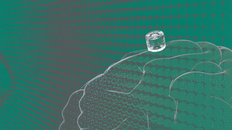 Motif Neurotech — Therapeutic Brain Computer Interface For Mental Health